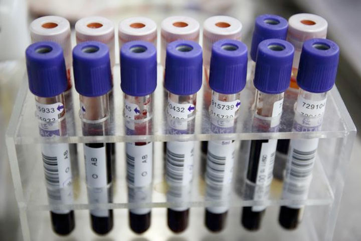 East Hanover Health Department Offers SMAC Blood Testing Program ...